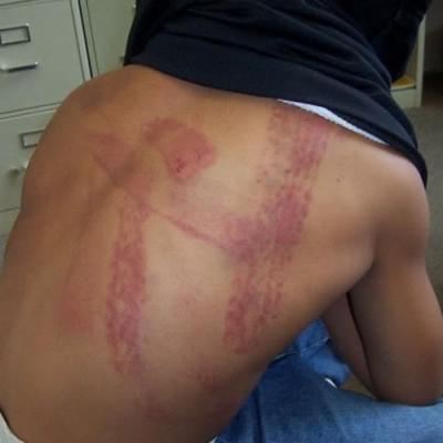 Corporal punishment of children remains common worldwide, UNC studies ...